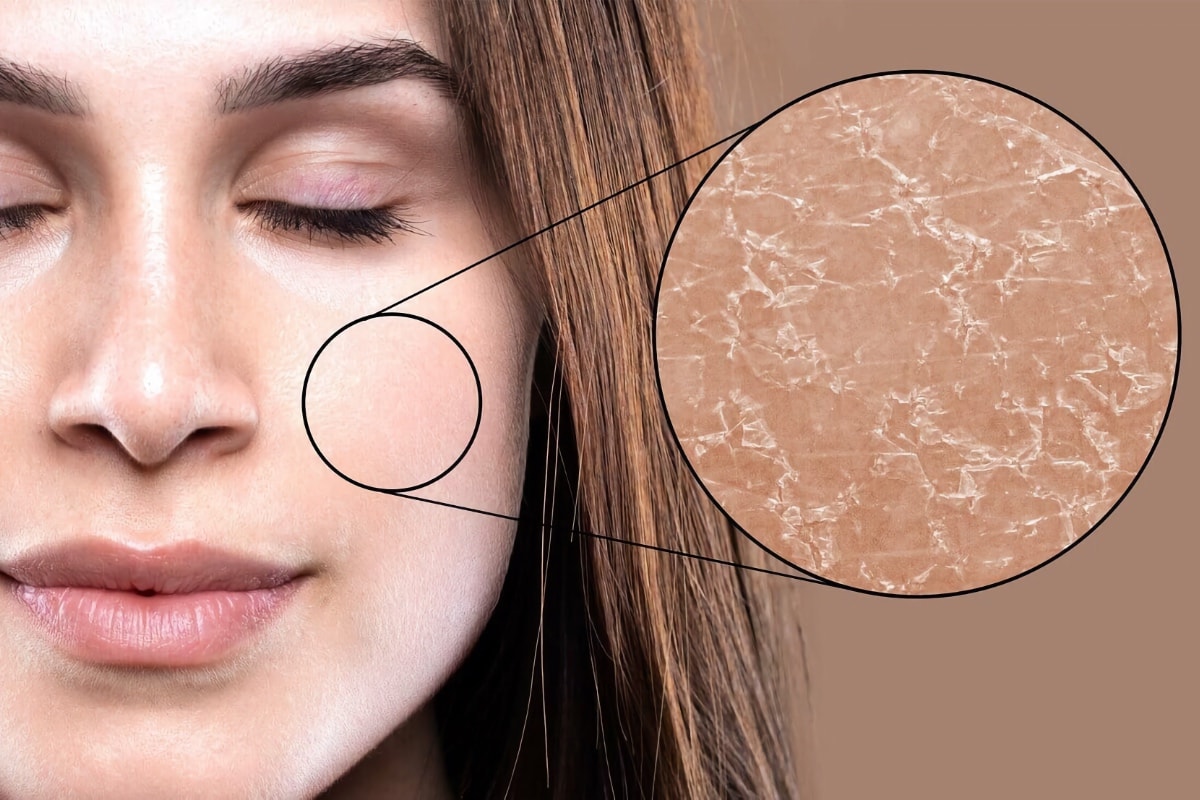 Сува кожа | Креми за сува кожа | Аптека ЕРИКС